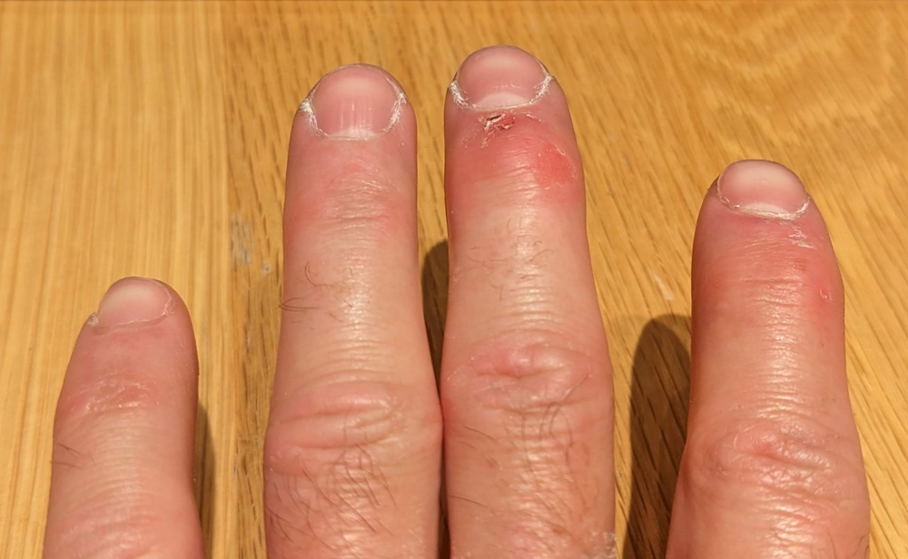 Taping for thin fingers